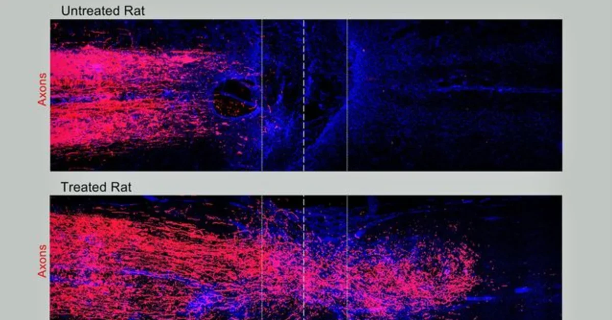 New therapy spurs nerve fibers to regrow through scar tissue, transmit ...